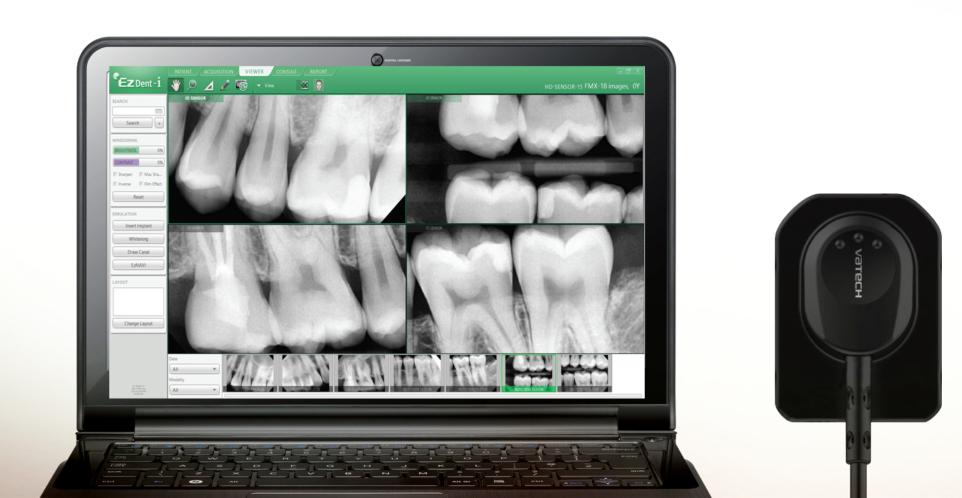 RADIOVISIOGRAFO VATECH EzSensor HD 1.5 (Precio Especial USD$1,900 +iva, Promoción 2024 ...