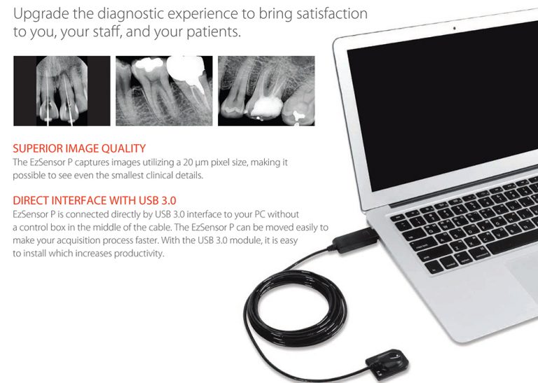 RADIOVISIOGRAFO VATECH EzSensor Classic 1.5 (Precio Especial USD$1,500 +iva Hasta Dic/2024 ...